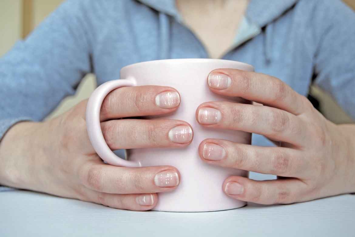 ️ 6 Anomalías en las uñas y lo que indican de tu salud